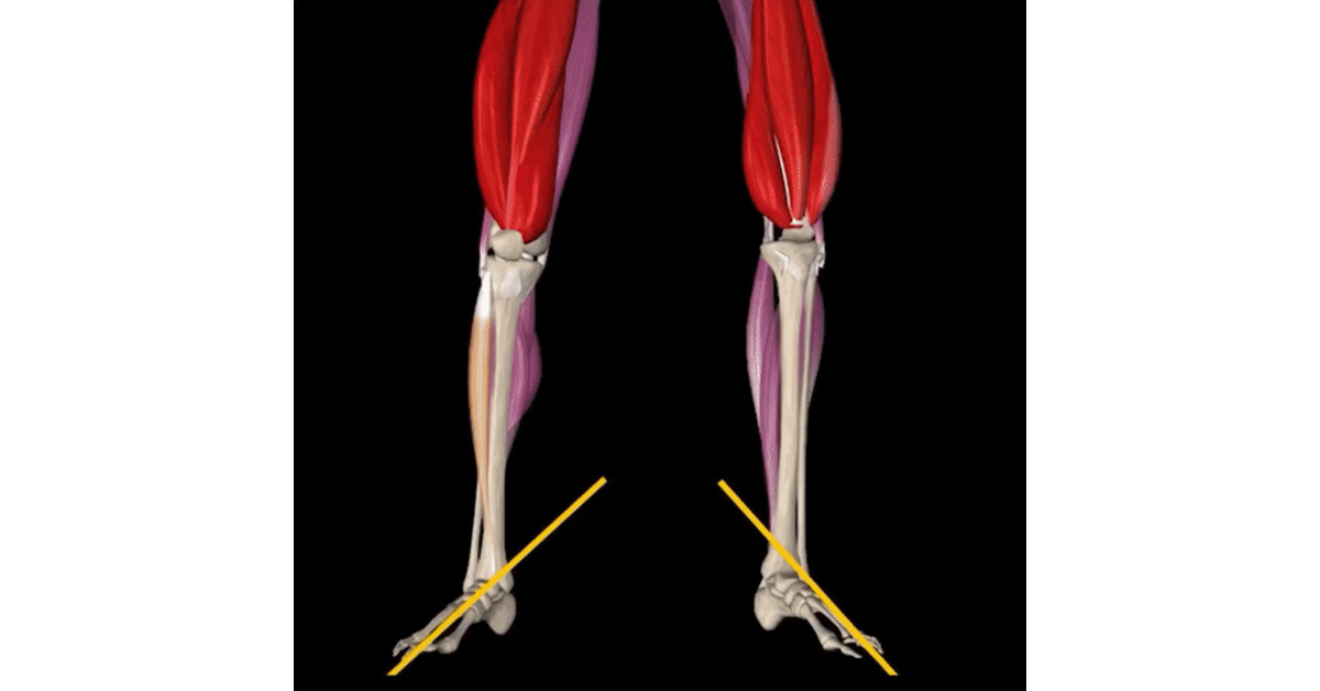 Squat Form Tip – Toes & Knees OUT, Not STRAIGHT! – Dr. Gains