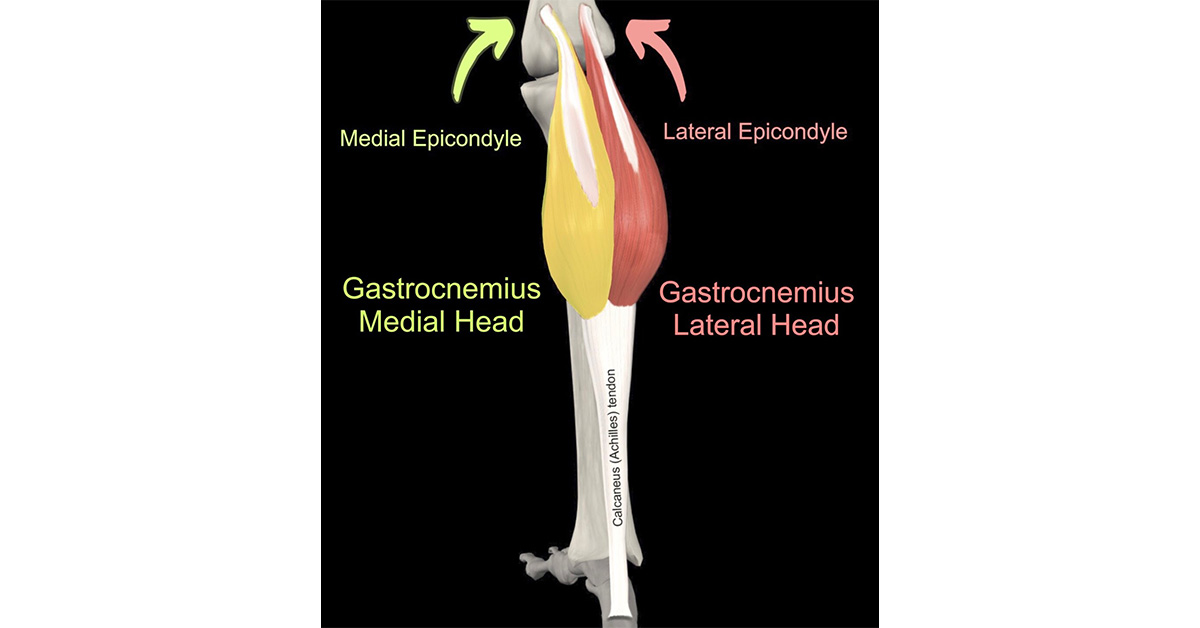 A Key to Calf Definition – Lateral vs Medial Gastroc Heads – Dr. Gains